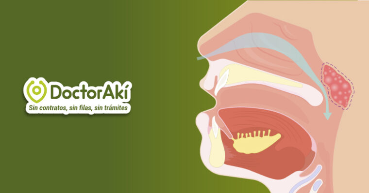 ¿Qué es la Adenoides? Signos y Causas | DoctorAkí