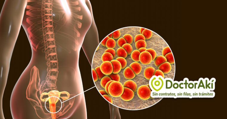 Gonorrea: Síntomas, Tratamiento y Prevención | DoctorAkí
